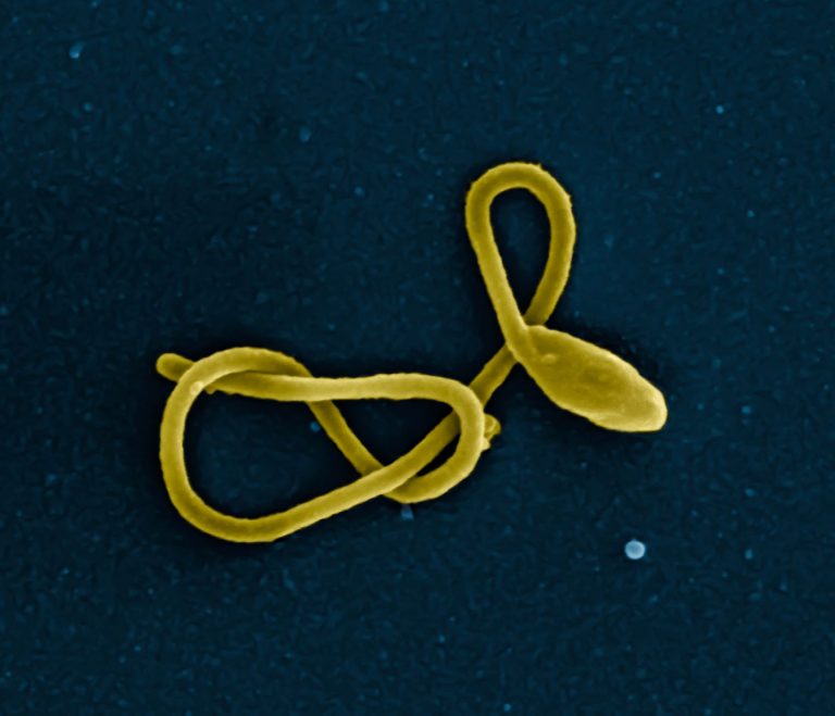 Ebola vírus, foto NIAID - Časopis Quark